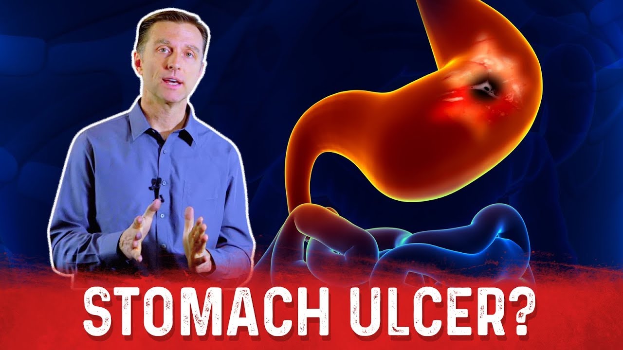 How to Fix a Stomach Ulcer—5 Natural Remedies | Dr. Berg