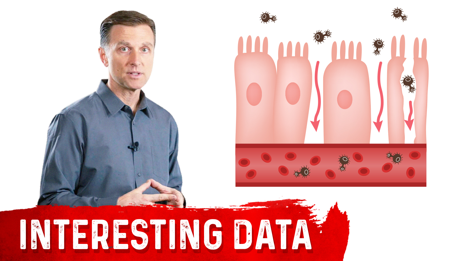 Intestinal Permeability or Leaky Gut | Healthy Keto™ Dr. Berg