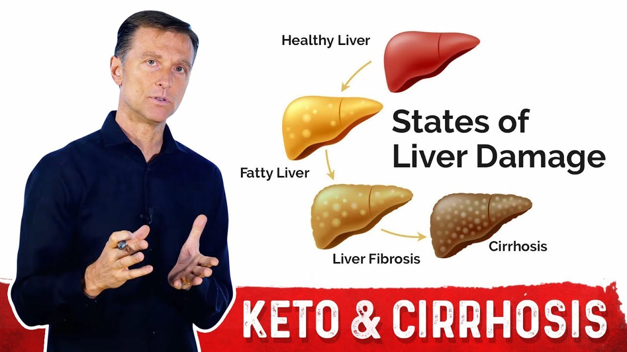Keto and Fatty Liver: How to Reduce Liver Fat Fast | Dr. Berg