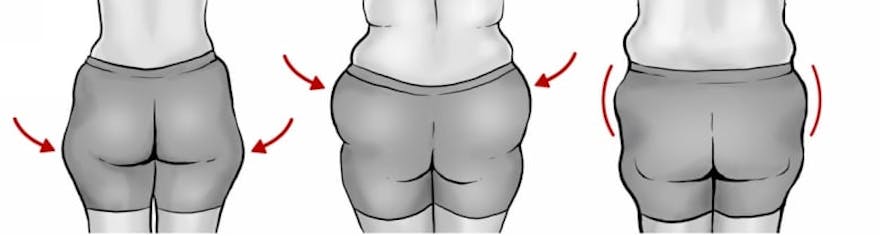 What Are the Four Body Types| Dr. Berg