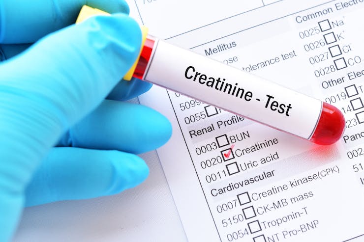 Five Foods High in Creatine | Dr. Berg