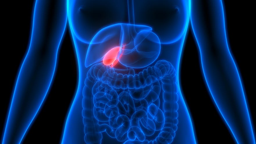 What You MUST Know If You Dont Have a Gallbladder| Dr. Berg