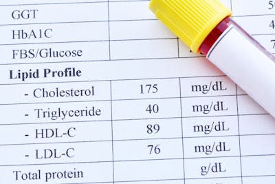 Understanding Cholesterol Levels and Numbers | Dr. Berg