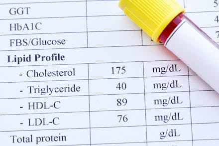 Understanding Cholesterol Levels and Numbers | Dr. Berg