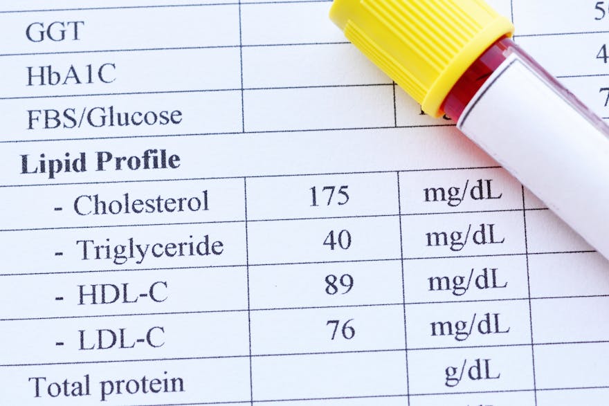 Understanding Cholesterol Levels and Numbers | Dr. Berg