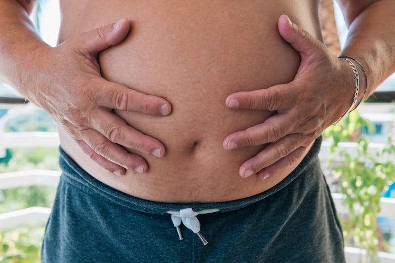 Ascites vs. Belly Fat: Know the Difference | Dr. Berg