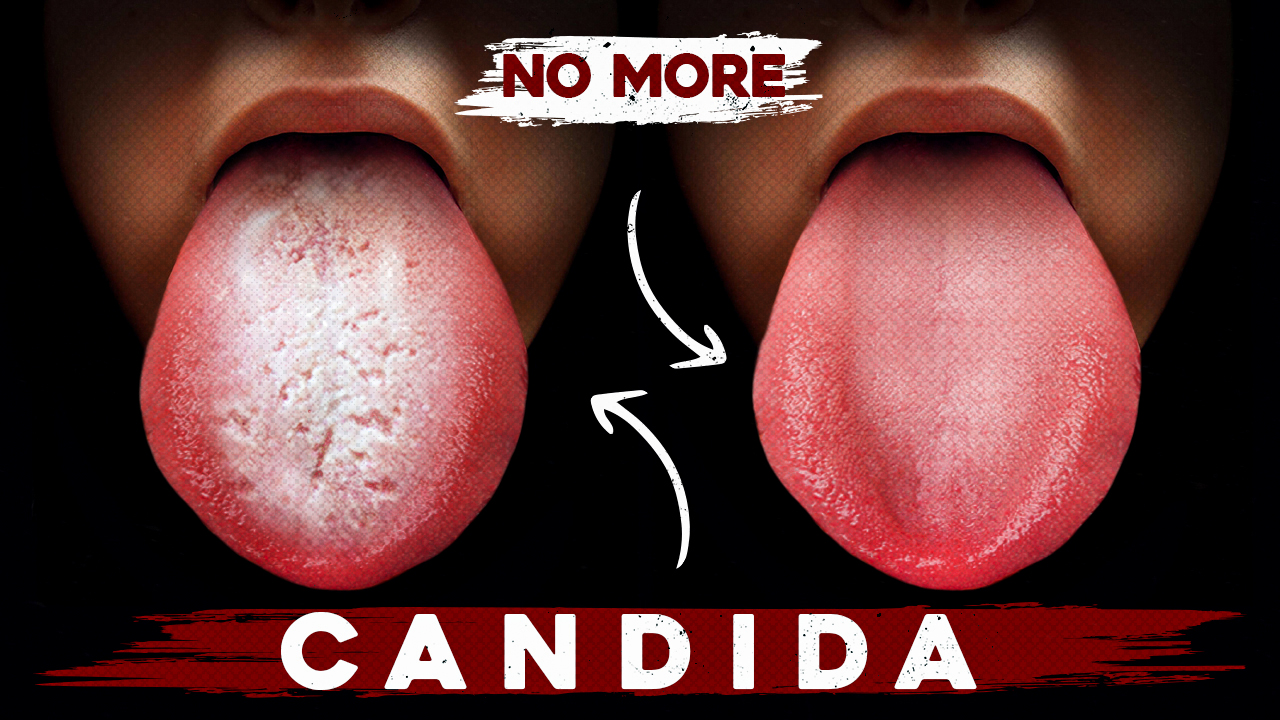 Conquer Candida: Effective Strategies for Lasting Relief