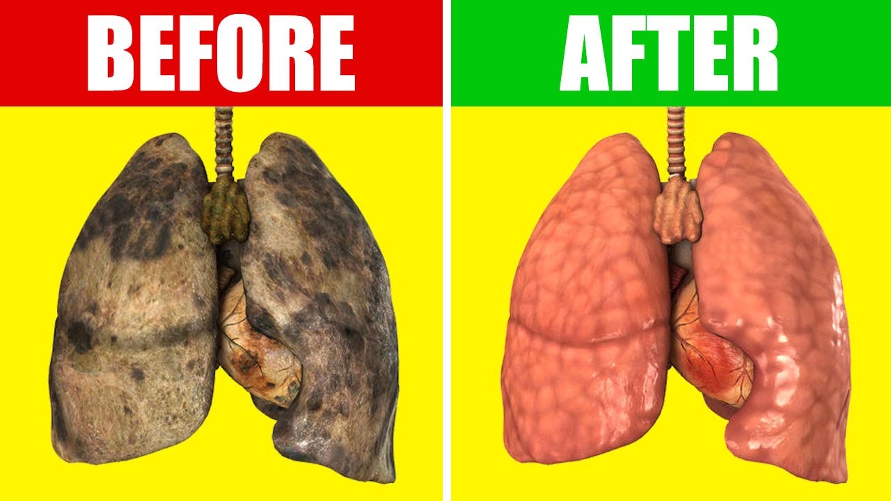 Discover the Secrets to Detoxify Your Lungs Effectively