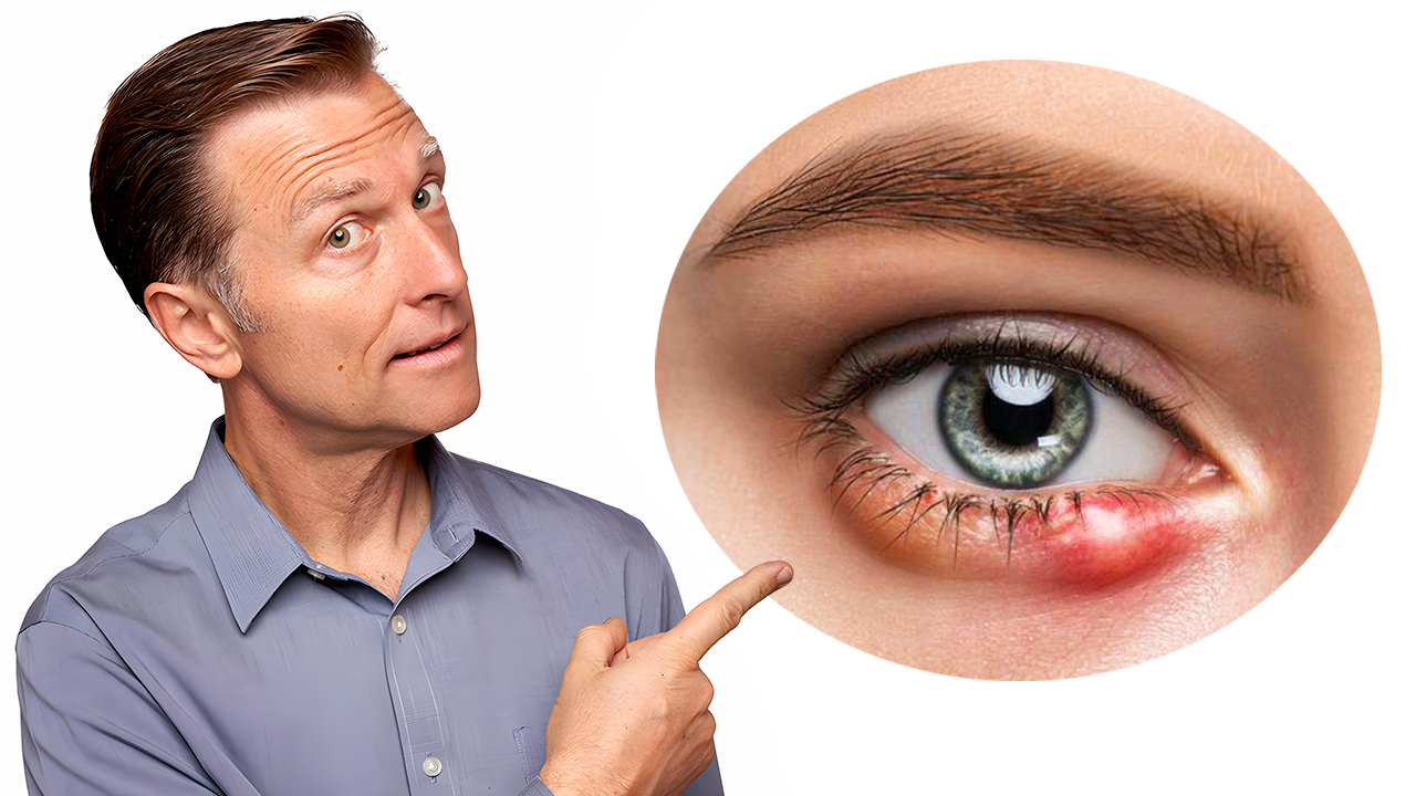 Cracking the Stye Code: What Really Causes Them?